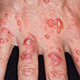 10 Most Bizarre Skin Diseases